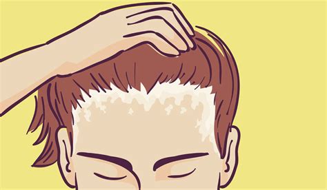 Hematoma What Is Causes Types Diagnosis And Treatment