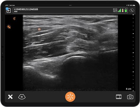 Pragmatic Msk Ultrasound 8 Step Protocol For Assessing The Distal