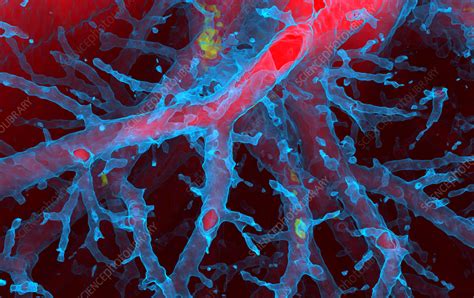 Healthy Lung Ct Scan Stock Image C0577903 Science Photo Library