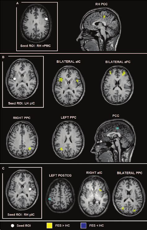Group Statistical Maps P 8 Download Scientific Diagram