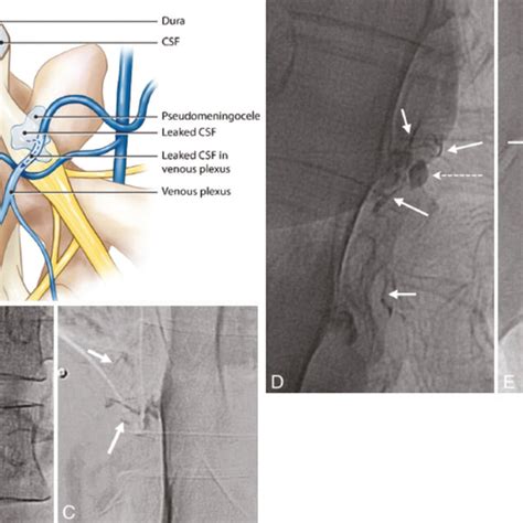 Representative Intraoperative Imaging With Fluoroscopic Localization Download Scientific