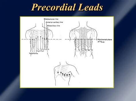 Pediatric Egc Interpretation Overview Of Pediatric Ecg Pdf