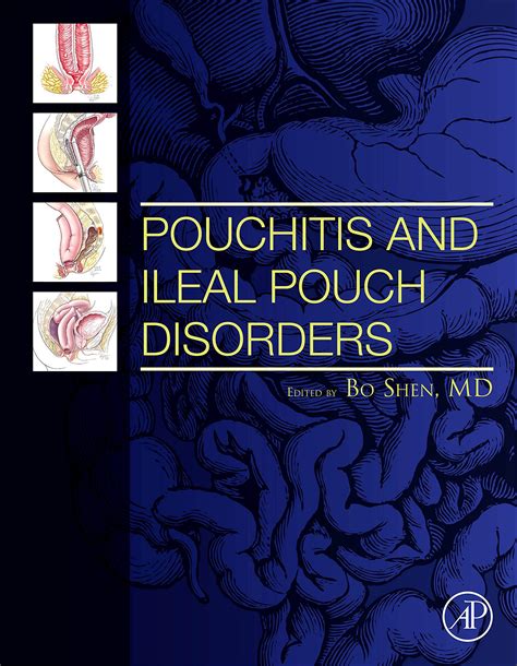 Pouchitis And Ileal Pouch Disorders A Multidisciplinary Approach For
