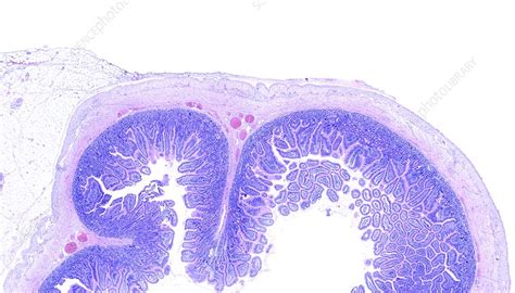 Duodenum Light Micrograph Stock Image C051 7266 Science Photo Library