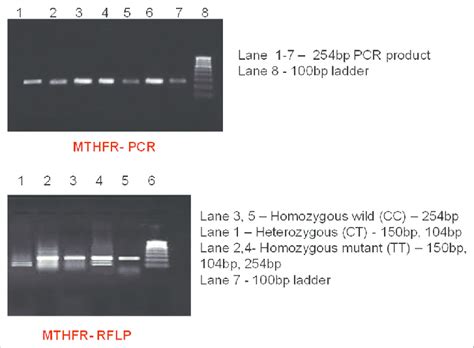 Analysis Of Polymorphism Using Pcr ‑ Rflp Technique Download Scientific Diagram