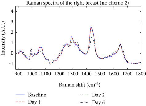 Variation Of Raman Spectra With Breast Tumor Growth And Without Breast Download Scientific
