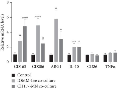Macrophages Are Enriched In Meningioma Tissue And Coculture With