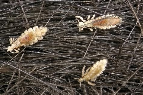 Picture Of Picture Of Lice