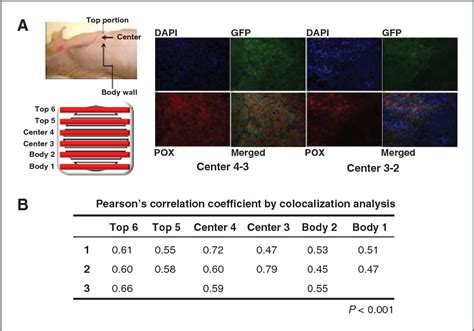 Figure 2 From Proline Oxidase Promotes Tumor Cell Survival In Hypoxic