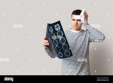 Young Man With Brain Concussion And Mri Scan On Light Background Stock