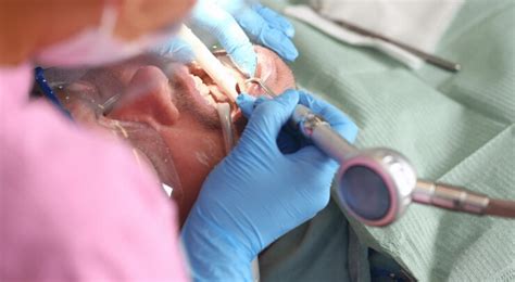 Expert Tips Tooth Extraction With Sinus Root Safe Practices