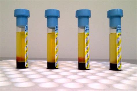 Celulas Madres Ezequiel Santa Coloma