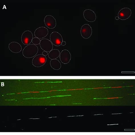 Analysis Of Dna Replication In Yeast And Human Cells With Idu And Cldu