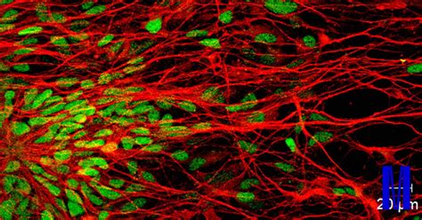 Scientists Discover How Nerve Cells Are Formed Science Science Muni Cz