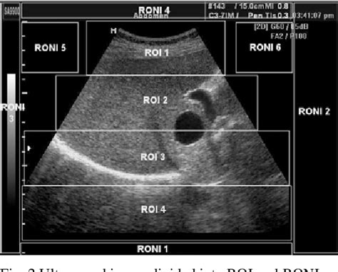figure 2 from reversible medical image watermarking for tamper