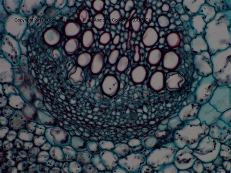 Cupac Anatomy Slide Images