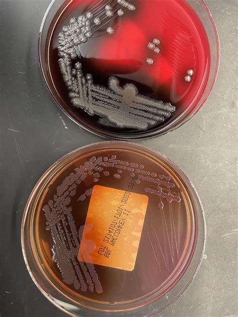 Pseudomonas Aeruginosa But With A Red Pigment Rmicrobiology