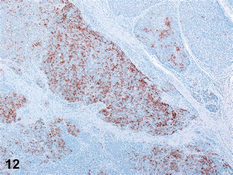 Biphasic Malignant Testicular Sex Cord Stromal Tumor In A Cotton Top Tamarin Saguinus Oedipus