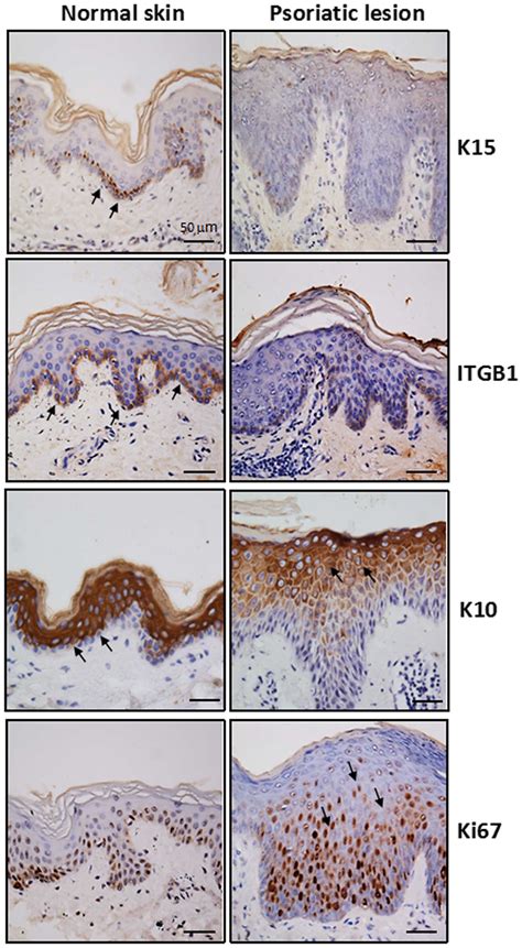 International Journal Of Molecular Medicine