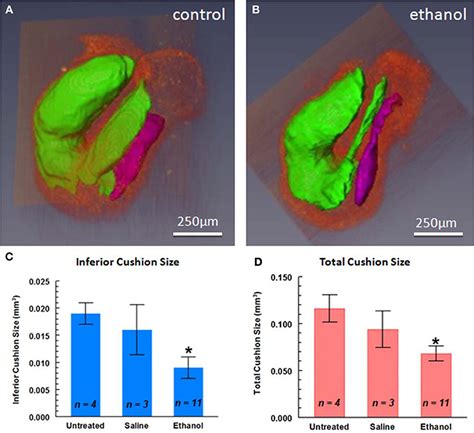 3 D Reconstruction Of Endocardial Cushion Volumes Of The Looping Heart Download Scientific