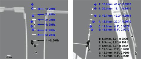 The Localization Result For Seven Single Dipoles Of Which Each Was Download Scientific Diagram