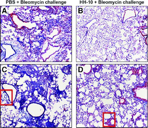 A D Representative Histology Of Bleomycin Challenged Murine Lungs