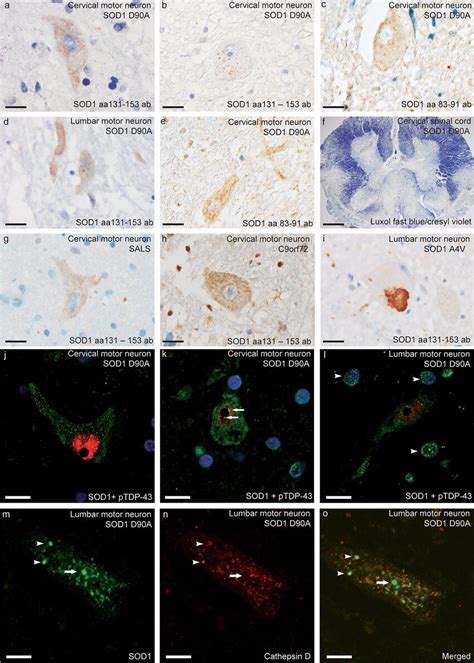 Sod1 Staining In Motor Neurons And Glial Cells In Spinal Cord Sections Download Scientific