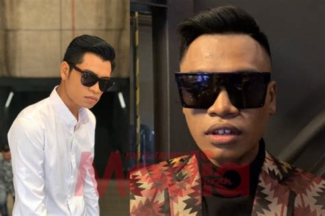 Digelar Usop Sontorian Diminta Pasang Buat Braces Reda Dengan Apa Allah Beri Usop