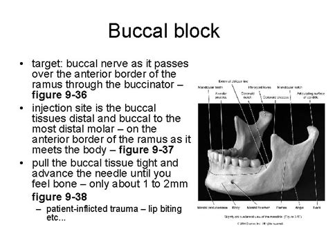 Local Anesthesia 1 Local Infiltration Type Of Injection