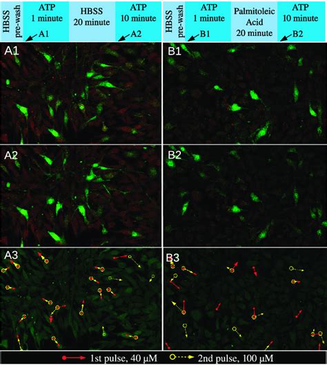 The Role Of Pacemaker Cells And Gap Junctions In The Early State Of