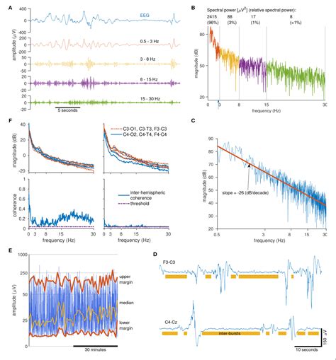 Figure 1 From Quantitative Preterm Eeg Analysis The Need For Caution