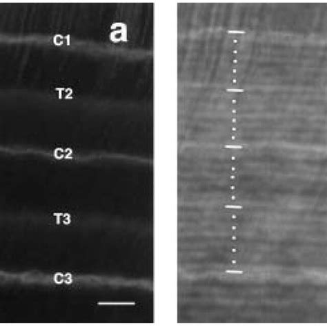 comparison of chronological labeling lines and incremental lines in