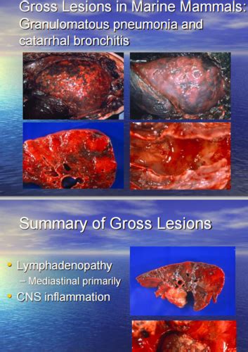 Microbio Pathogen Name Flashcards Quizlet