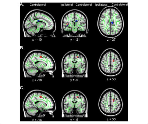 Changes In Diffusivity Indices Axial Diffusivity AD Mean Download Scientific Diagram