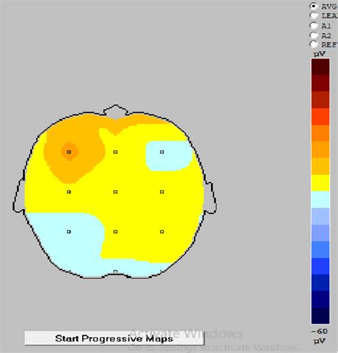 Visual Stimulus Single Map Download Scientific Diagram