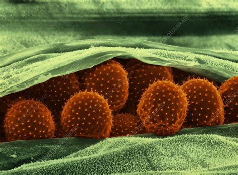 Wheat Leaf Rust Sem Stock Image C0221113 Science Photo Library