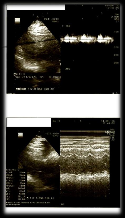 Echocardiography Doppler Download Scientific Diagram