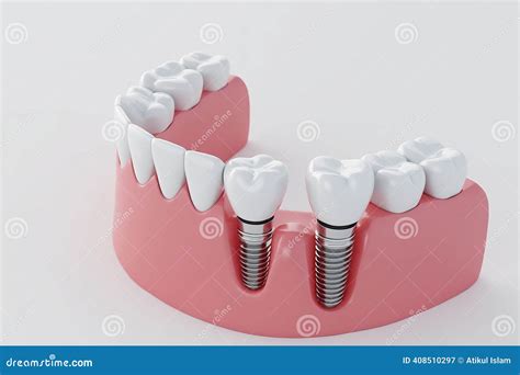 Artificial Denture Model Dental Health Complete Teeth Set Oral Care