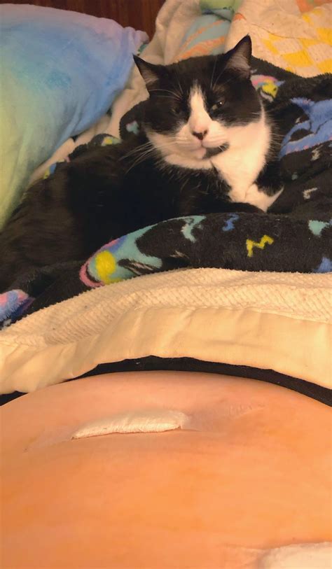 261 Best Gallbladder Images On Pholder Gallbladders Progresspics And