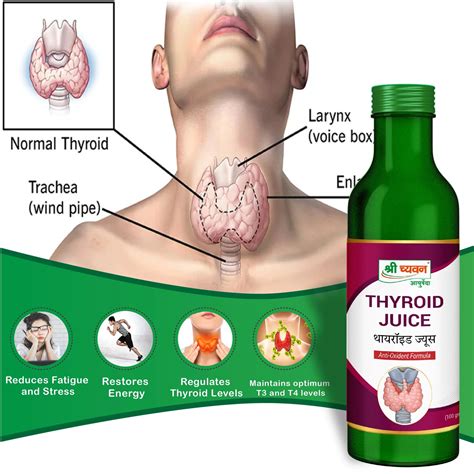 Thyroid Medicine Thyroid Ayurvedic Treatment
