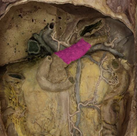 Anatomy Lab 2 Quiz Flashcards Quizlet