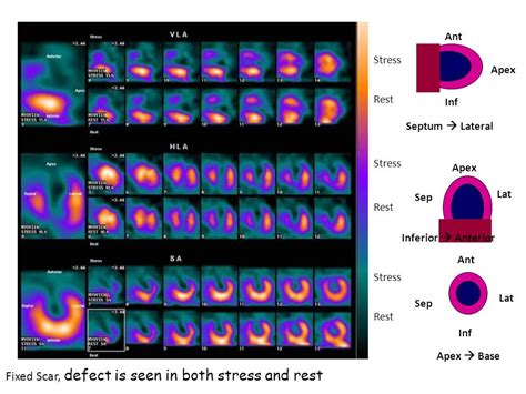 Principles Of Nuclear Cardiology Ppt Video Online Download