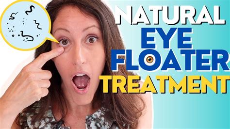 Floaters Eye Worm At Jimmy Ashman Blog