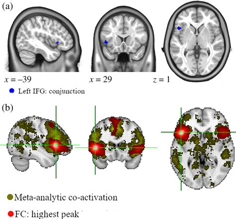 Conjunction And Meta‐analytic Co‐activation Analysis A Reduced Gmv