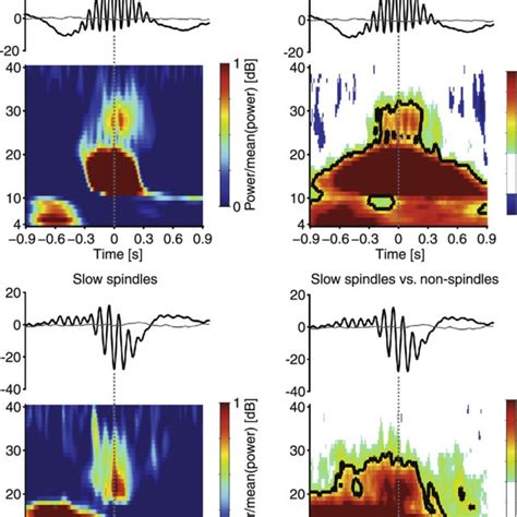 Cross Frequency Coherence Of Meg Gamma Band Activity During Fast And