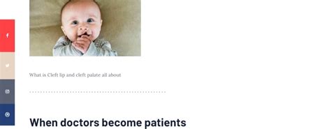 Ndubuisi Agughara On Linkedin Smiletrain Cleftawareness