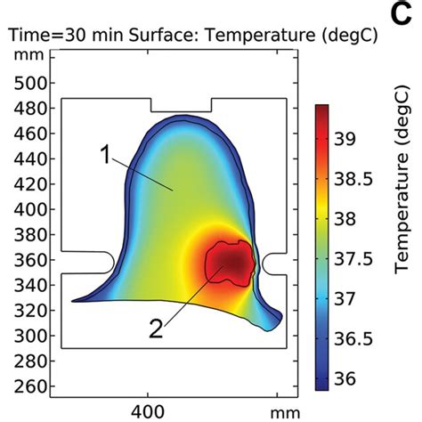 Color Doppler Ultrasound Image Of Patients With Positive Ovarian Sex