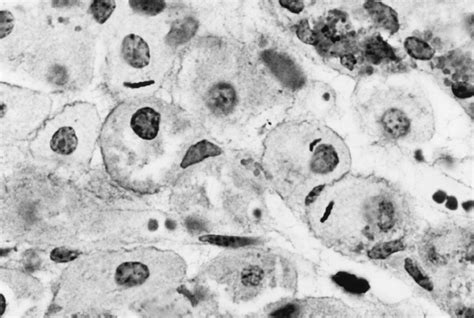 Intracellular Localization Of H Felis In The Fundus Of Cat 3 Modified