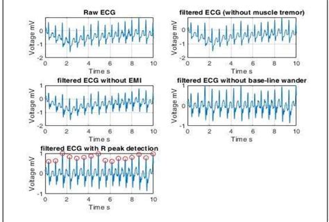 Ecg Signal Pre Processing Left To Right Ecg Signals Are
