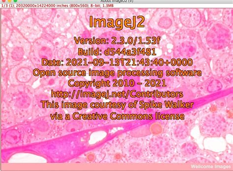 Analyze Skeleton Plugin Giving Wrong Measurements Image Analysis
